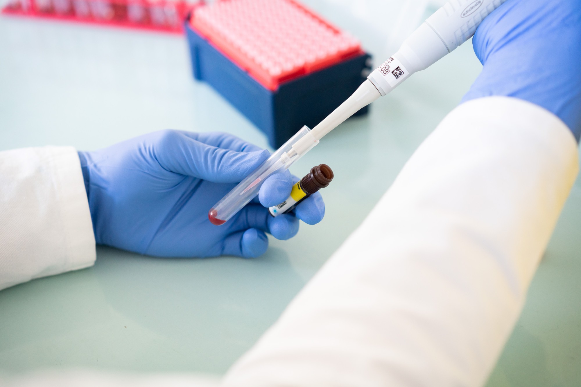 Diagnostik | Labor für Haematologie Mannheim